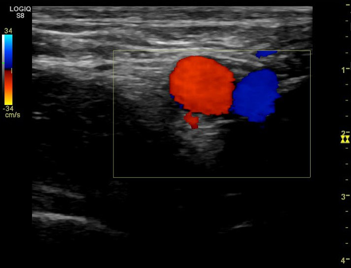 Echographie | France Imageries Territoires, Structurer, Innover et ...